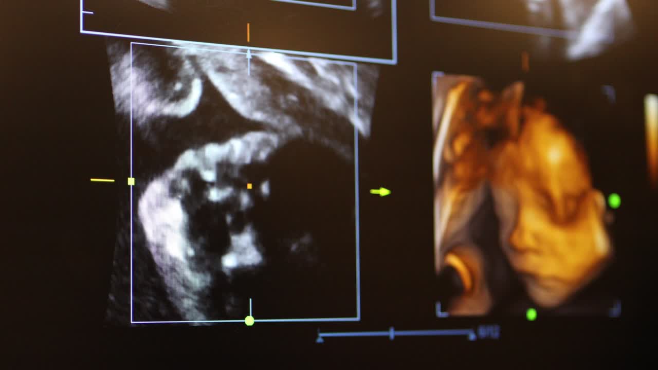 I See Baby Ultrasound Website